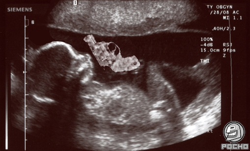 Arizona 'pro-life' bill promises a gun for every unborn child - POCHO